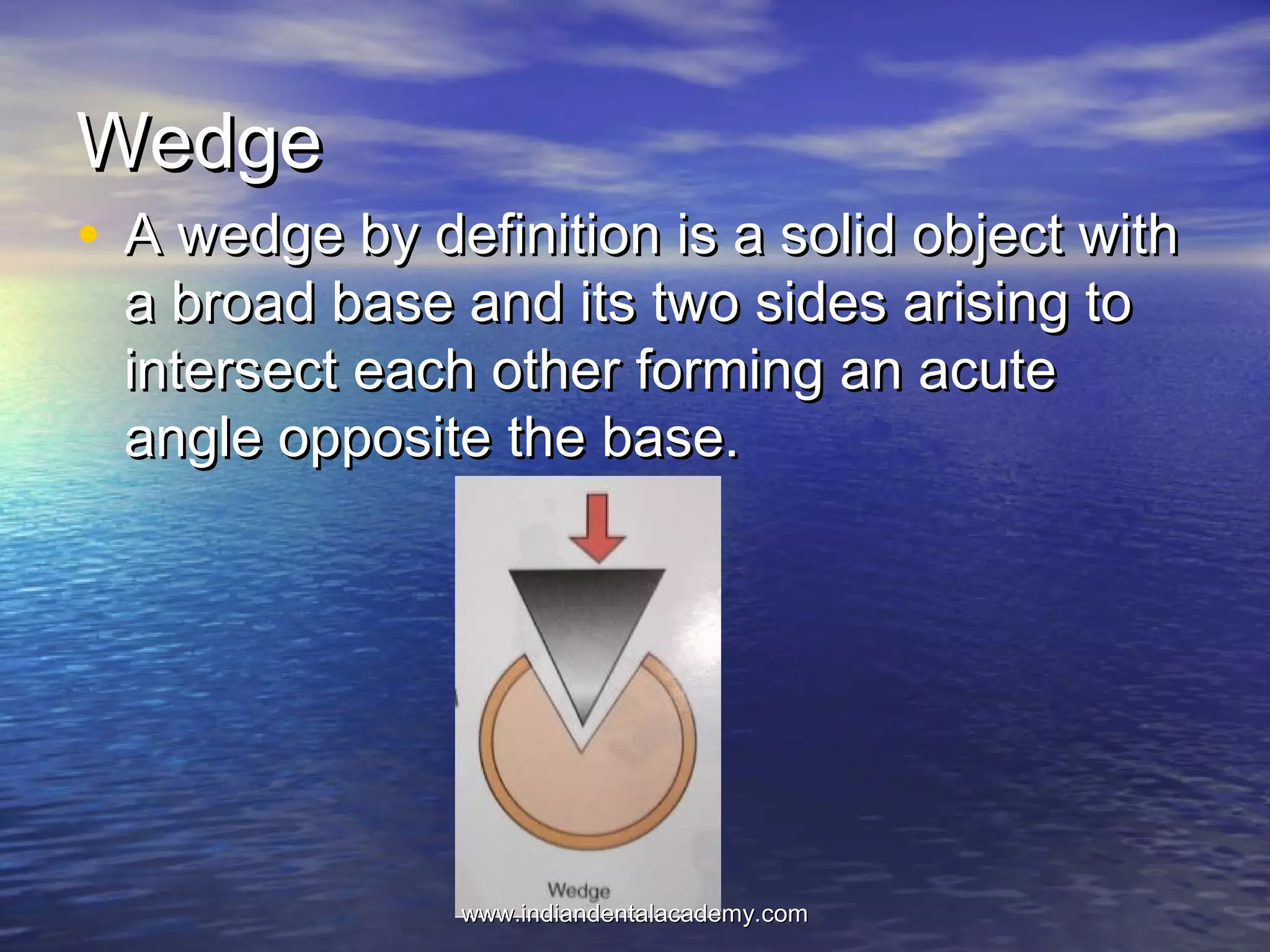 Design considerations for a distal extension rpd/prosthodontic courses ...