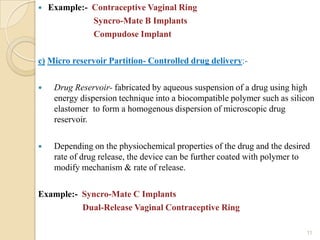 Design & development of implantable products: By Bhupendra Yadav | PPTX
