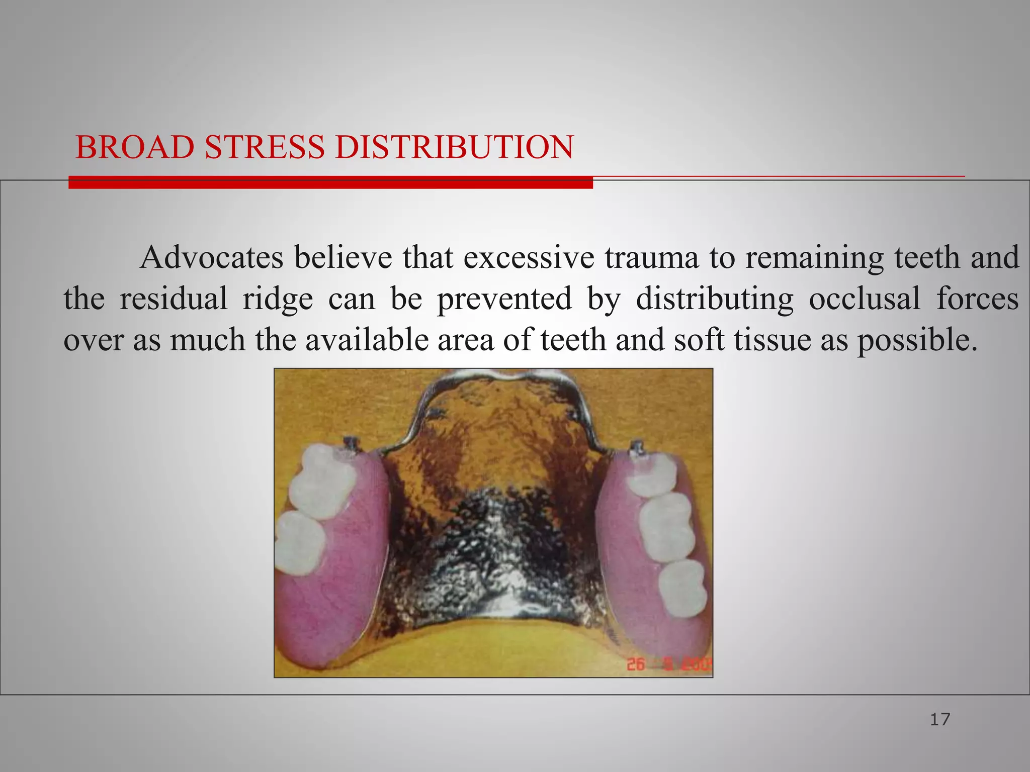 Designing for kennedy class i and class ii | PPT