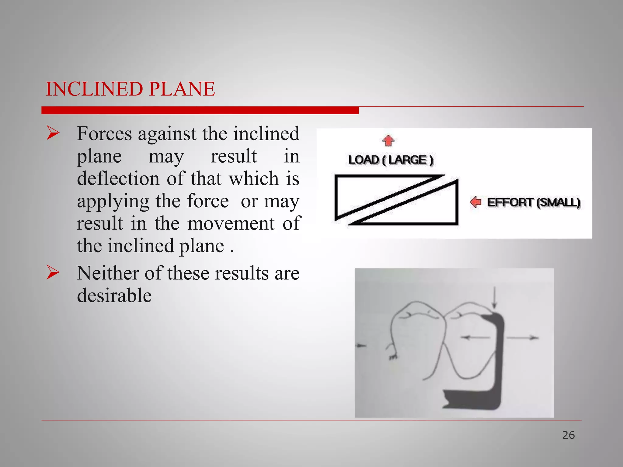 Designing for kennedy class i and class ii | PPT