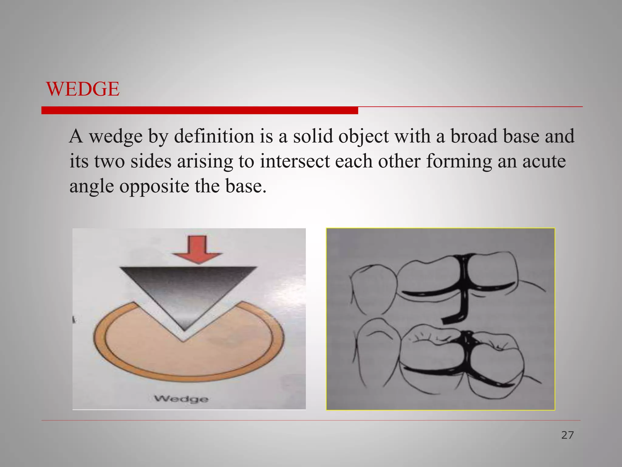 Designing for kennedy class i and class ii | PPT
