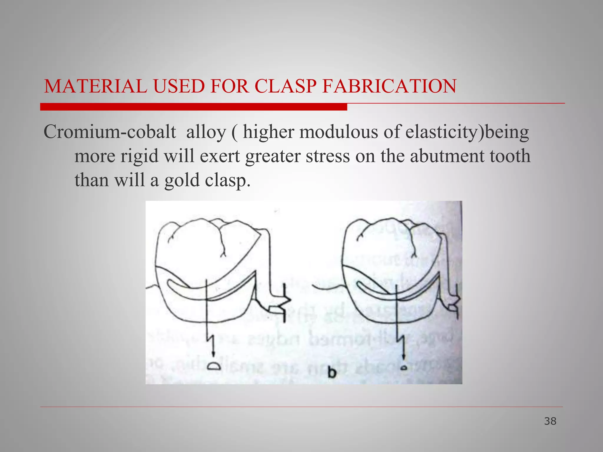 Designing for kennedy class i and class ii | PPT