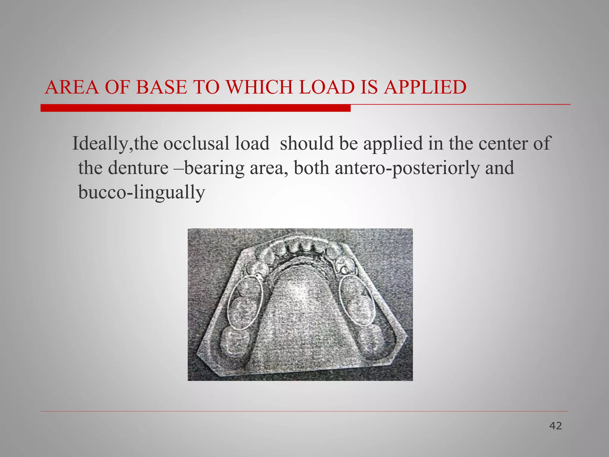 Designing for kennedy class i and class ii | PPT