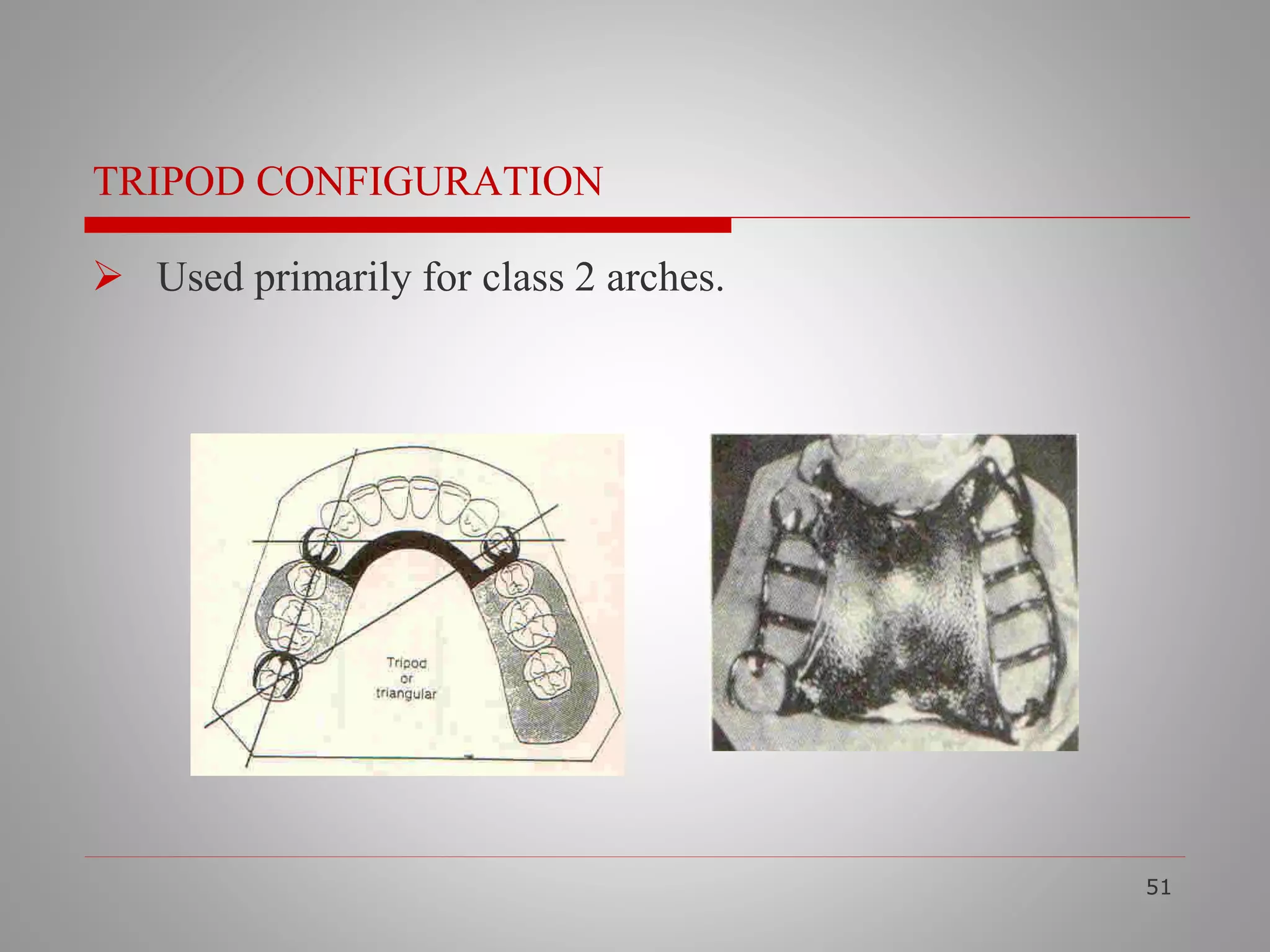 Designing for kennedy class i and class ii | PPT