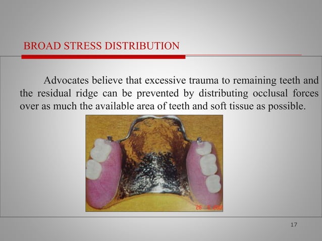 Designing for kennedy class i and class ii | PPT | Oral care | Personal ...