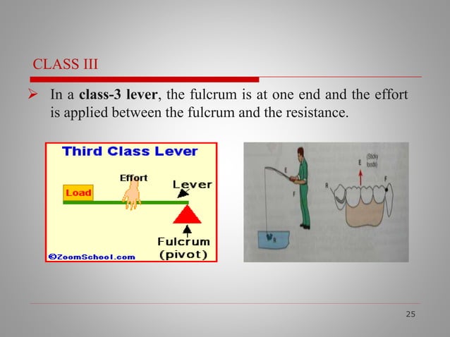 Designing for kennedy class i and class ii | PPT | Oral care | Personal ...