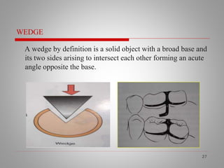 Designing for kennedy class i and class ii | PPT