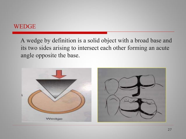 Designing for kennedy class i and class ii | PPT | Oral care | Personal ...