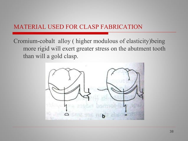 Designing for kennedy class i and class ii | PPT | Oral care | Personal ...