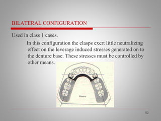 Designing for kennedy class i and class ii | PPT