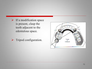 Designing for kennedy class i and class ii | PPT