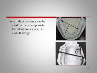 Designing for kennedy class i and class ii | PPT