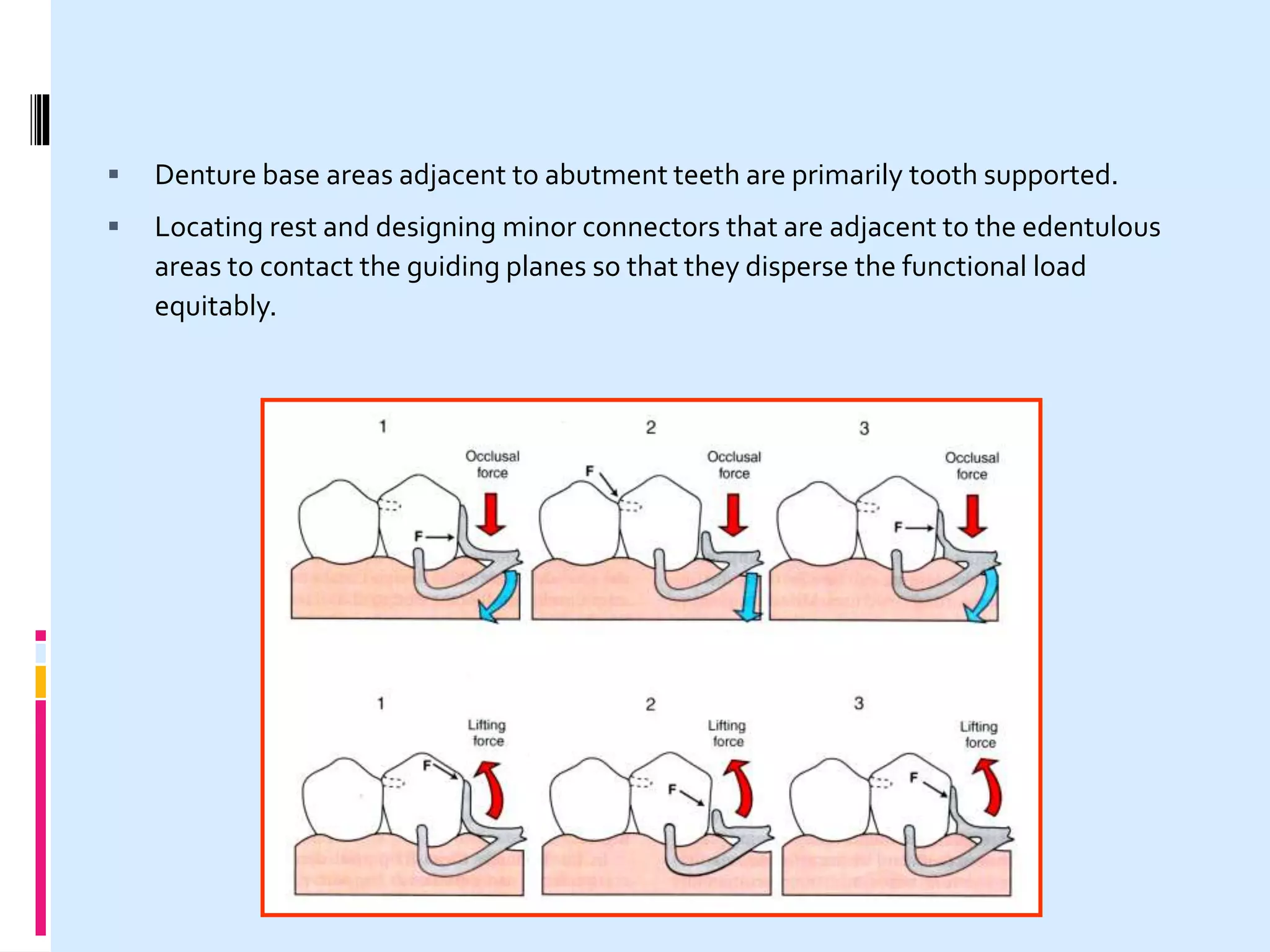 Designing for kennedys cl iii & iv | PPT
