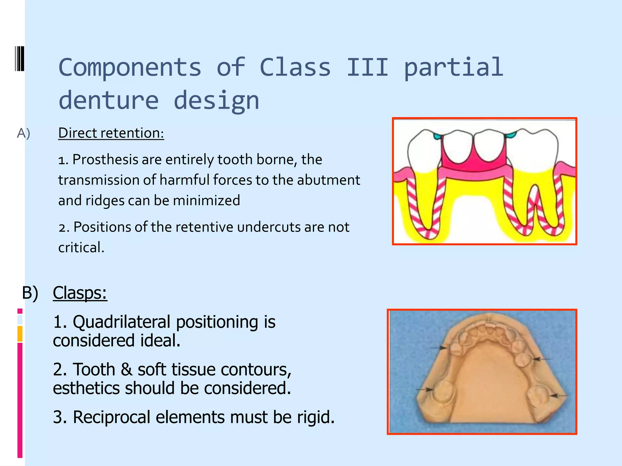 Designing for kennedys cl iii & iv | PPT