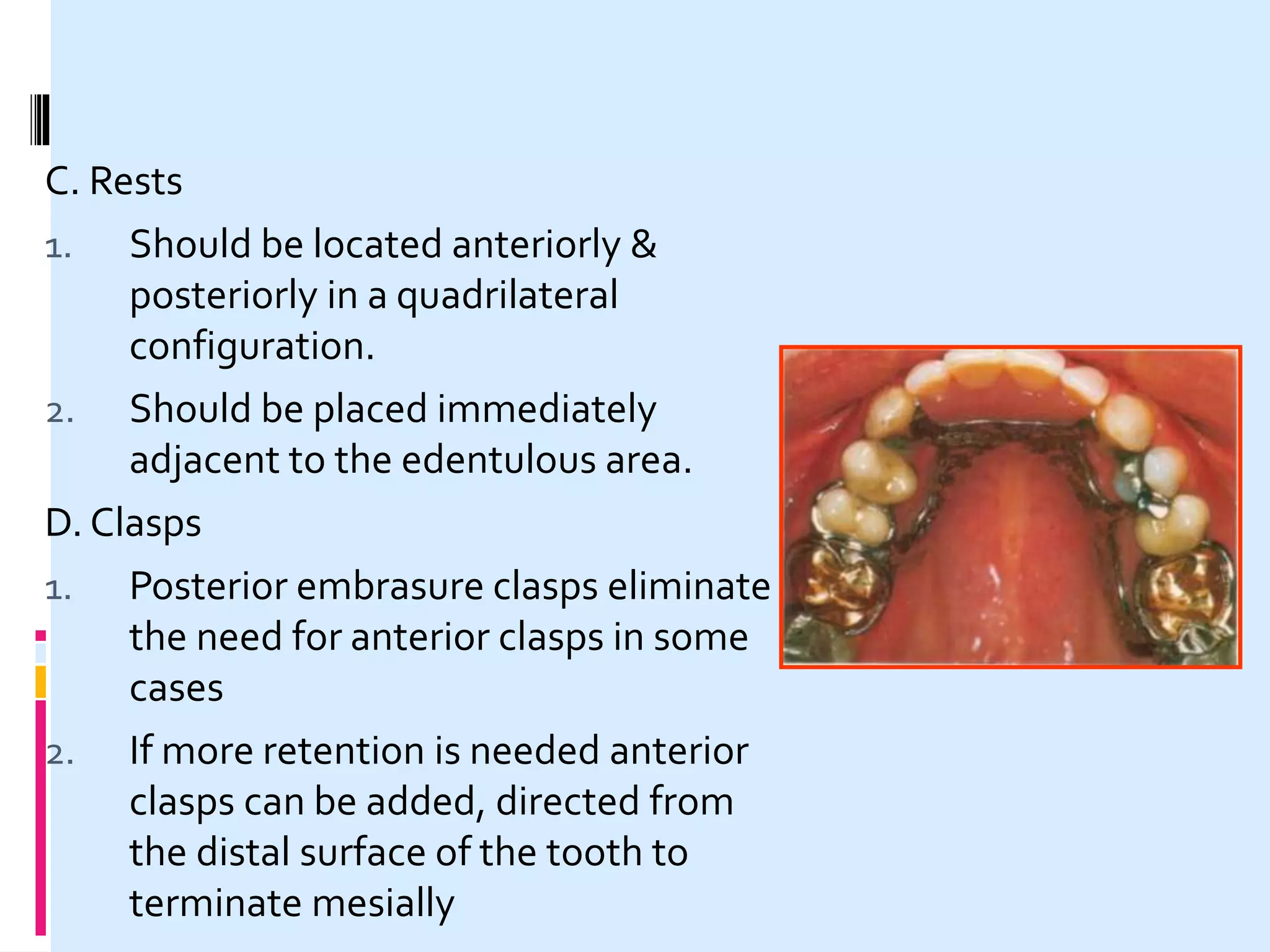 Designing for kennedys cl iii & iv | PPT