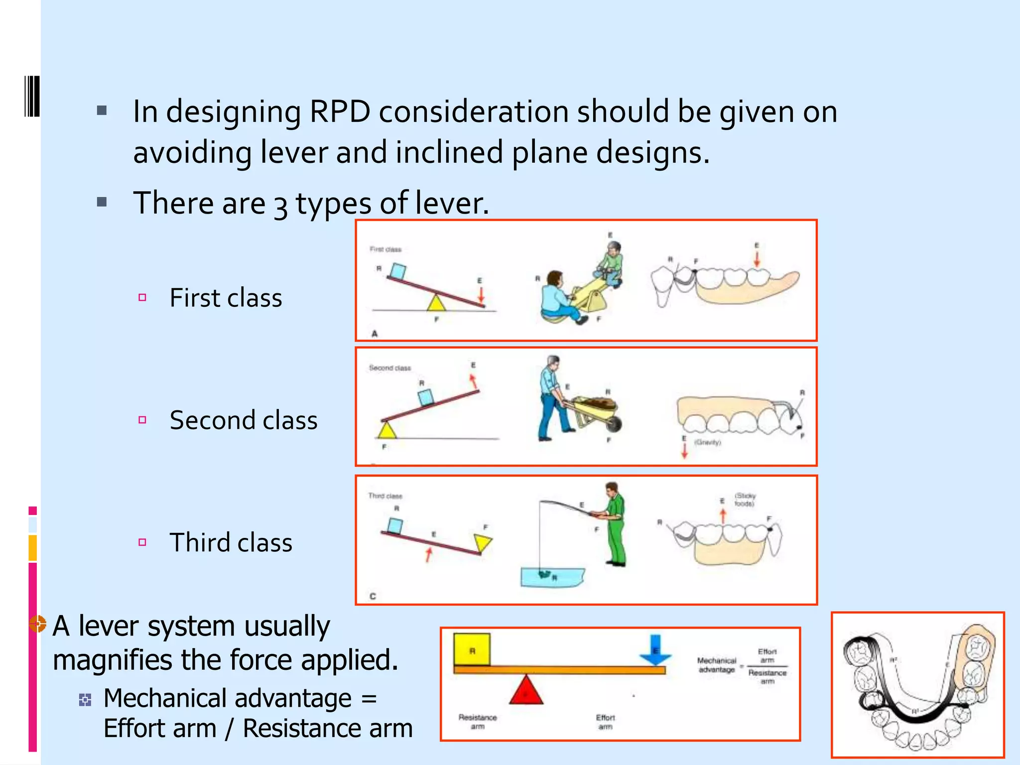 Designing for kennedys cl iii & iv | PPT