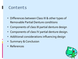 Designing for kennedys cl iii & iv | PPT