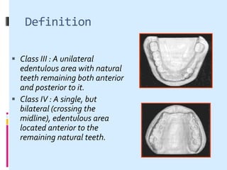 Designing for kennedys cl iii & iv | PPT