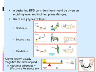 Designing for kennedys cl iii & iv | PPT