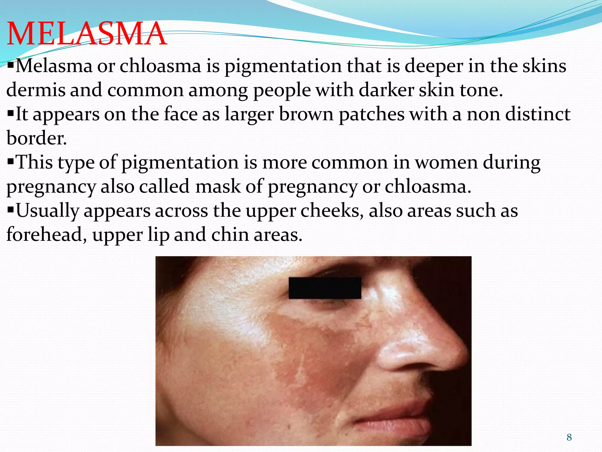 Designing of cosmeceutical product addressing pigmentation | PPTX