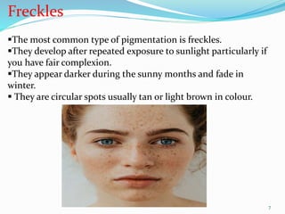 Designing of cosmeceutical product addressing pigmentation | PPTX