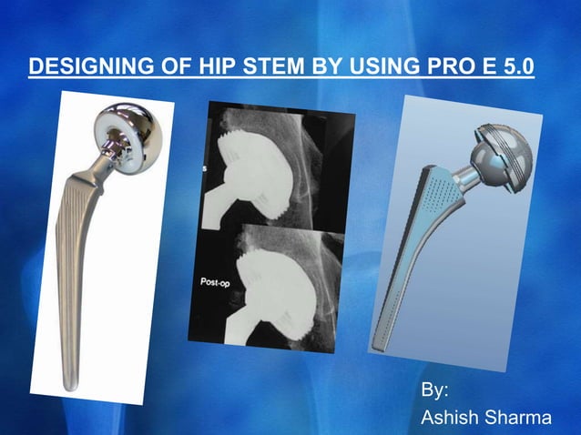 HIPS STEM DESIGN-- Ashish Sharma | PPTX | Bone and Joint Conditions ...