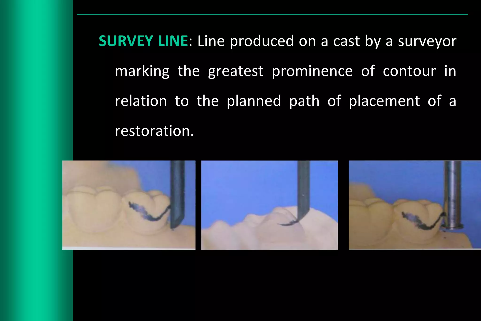 Designing of rpd | PPTX