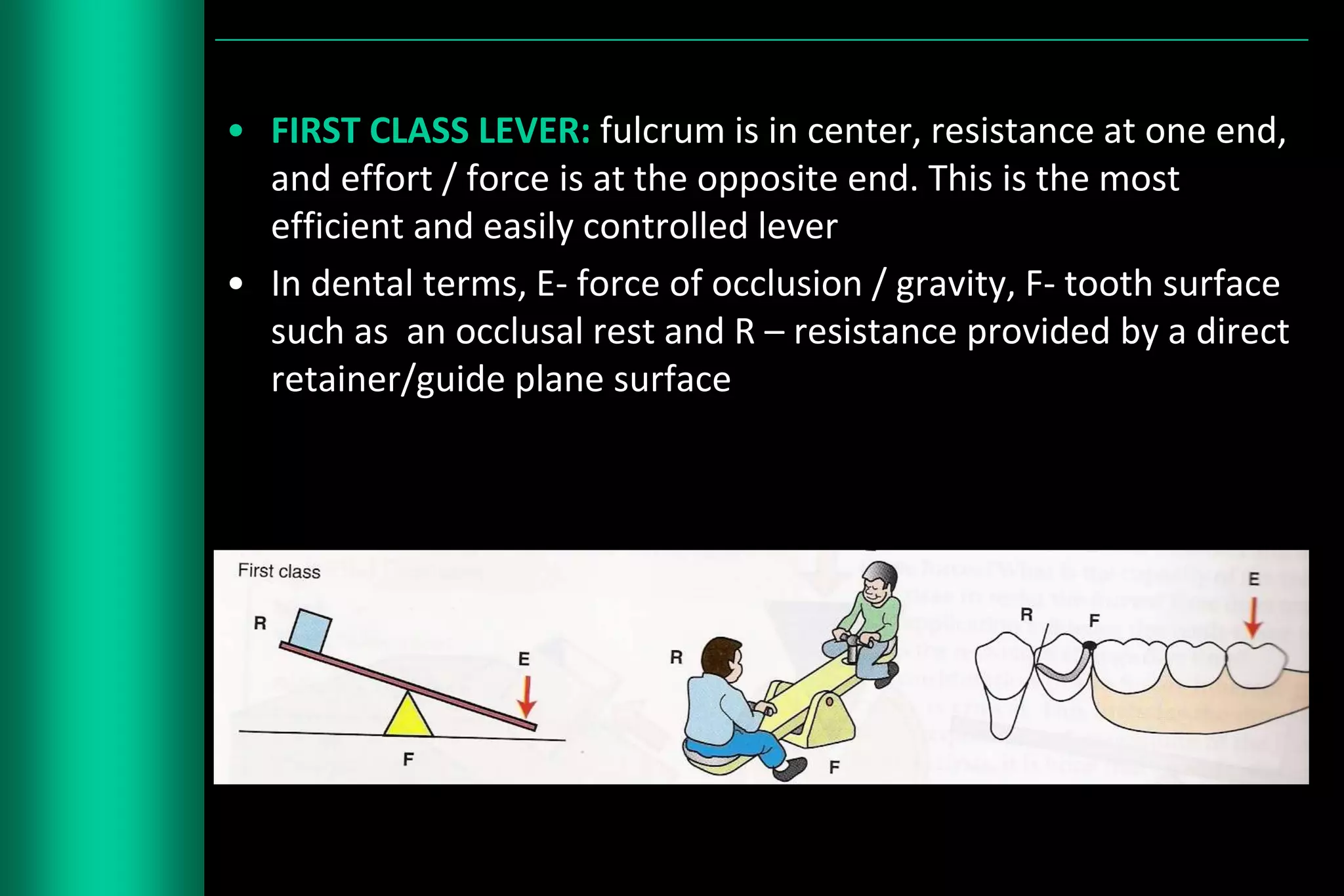 Designing of rpd | PPTX
