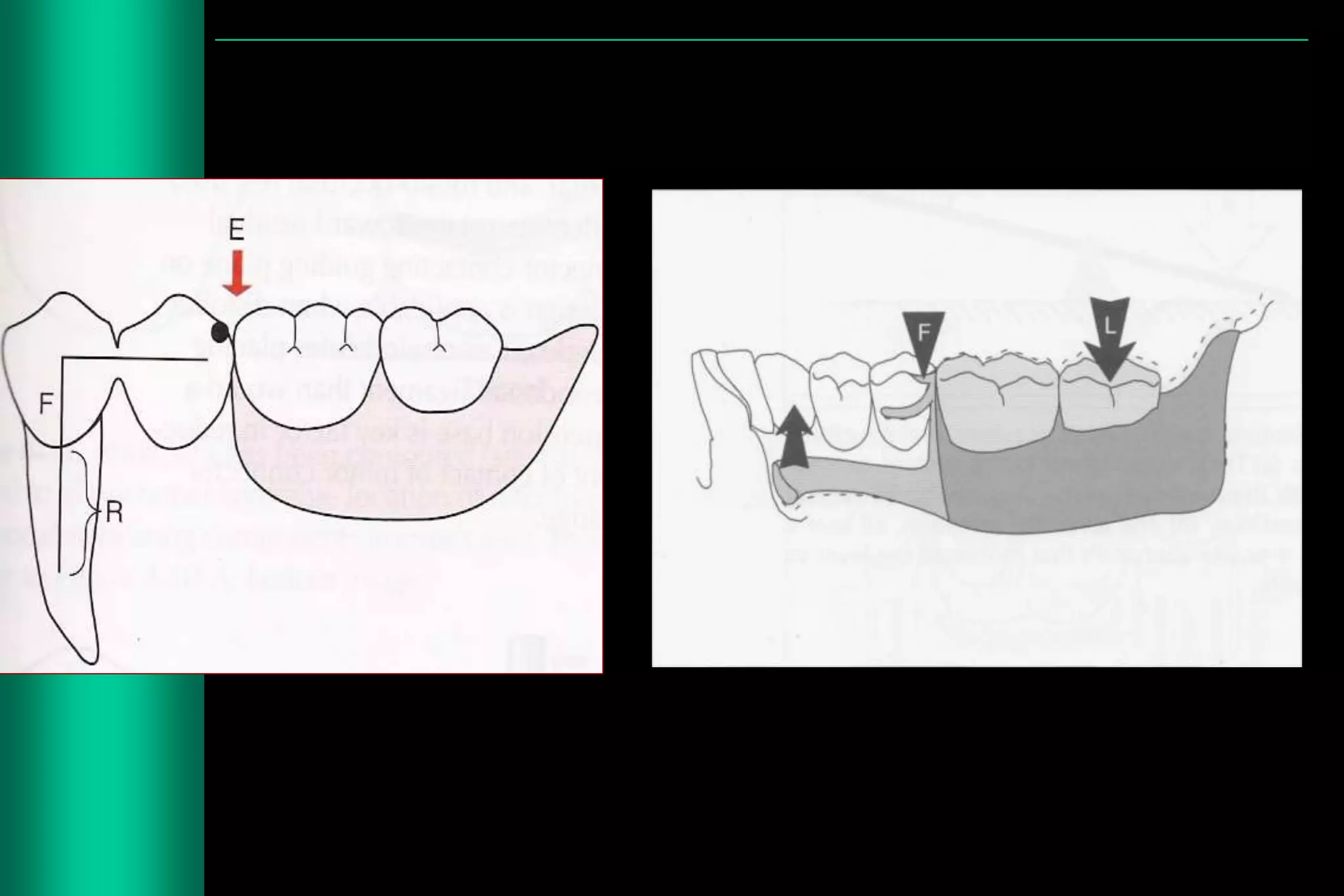 Designing of rpd | PPTX