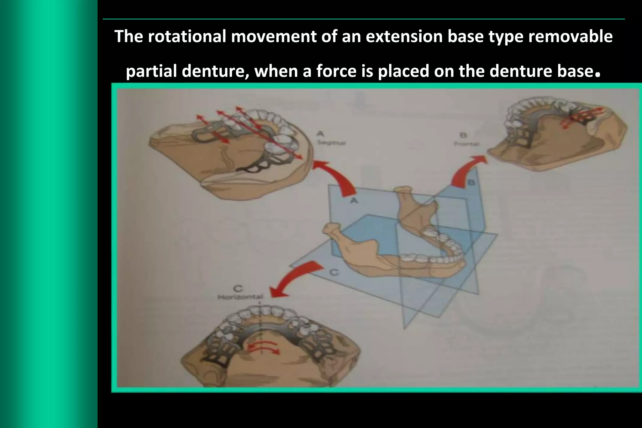 Designing of rpd | PPTX