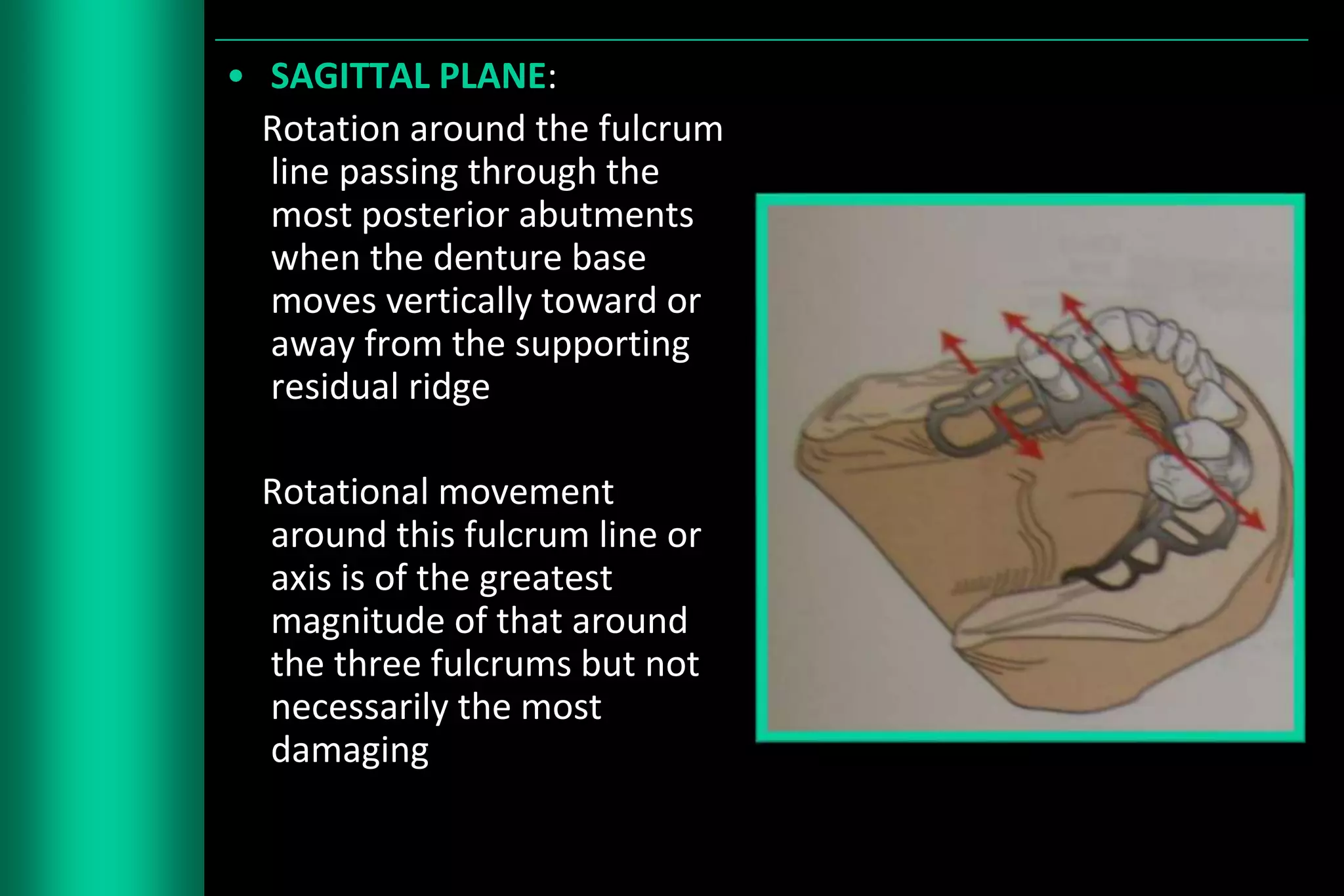 Designing of rpd | PPTX