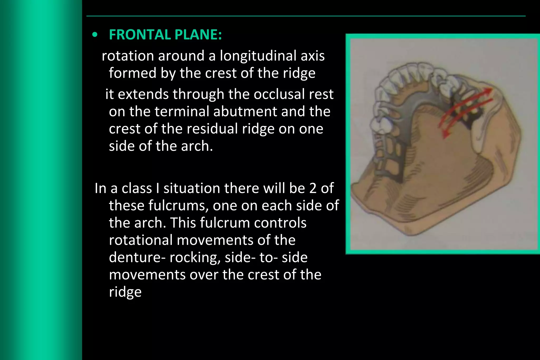 Designing of rpd | PPTX