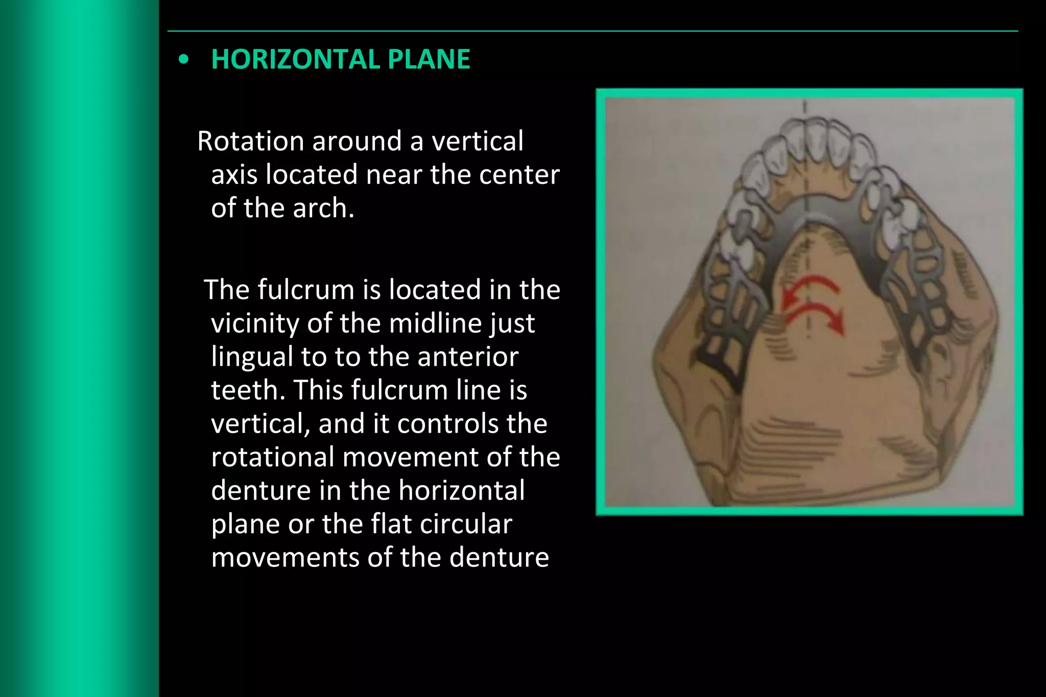 Designing of rpd | PPTX