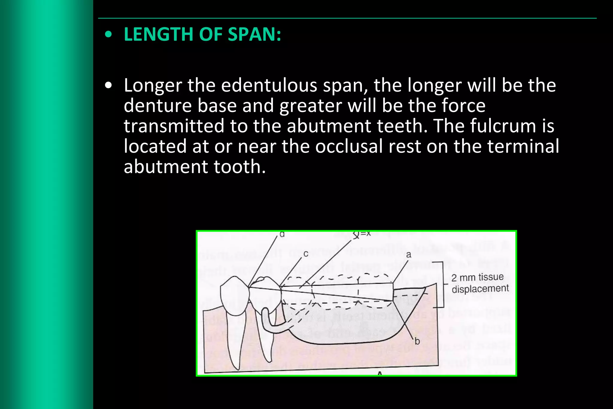 Designing of rpd | PPTX