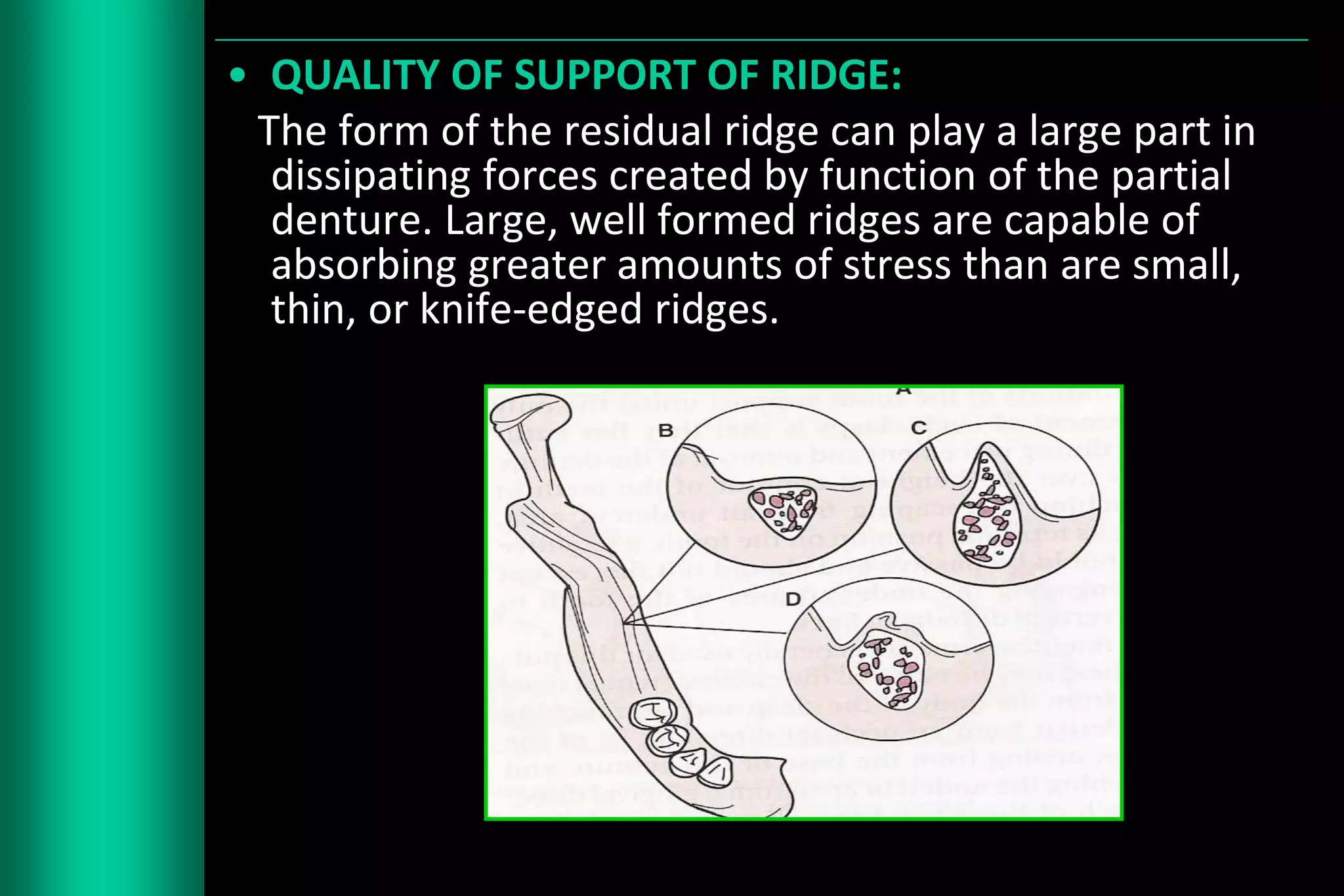 Designing of rpd | PPTX
