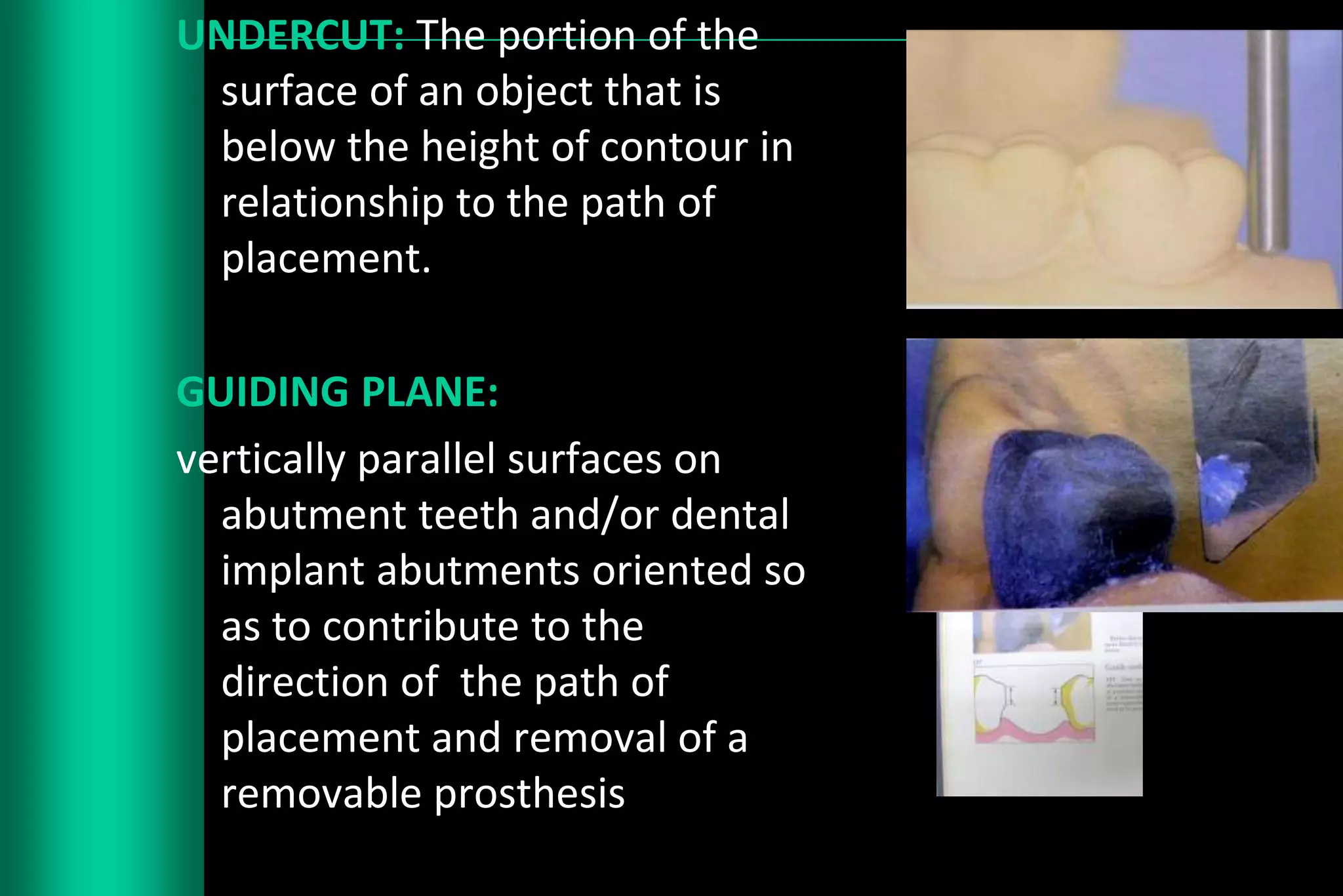 Designing of rpd | PPTX