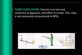 Designing of rpd | PPTX