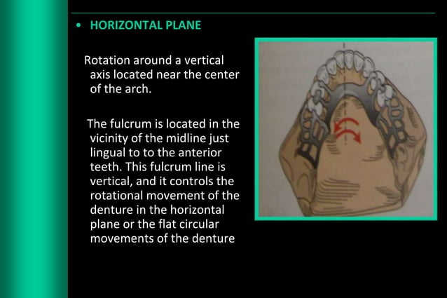 Designing of rpd | PPTX | Dental Health | Diseases and Conditions