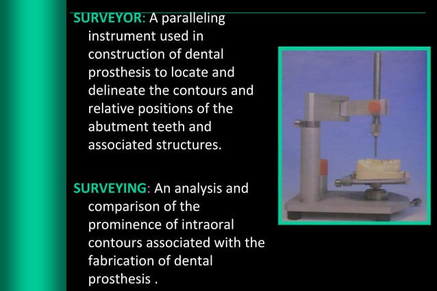 Designing of rpd | PPTX | Dental Health | Diseases and Conditions