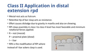 designing principles of Removable partial denture.pptx