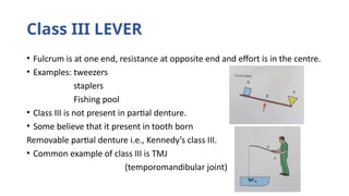 designing principles of Removable partial denture.pptx