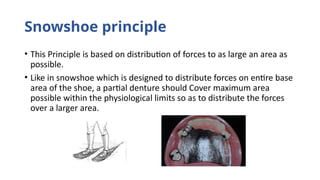 designing principles of Removable partial denture.pptx