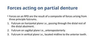 designing principles of Removable partial denture.pptx