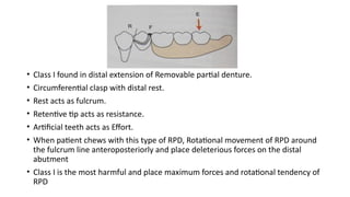 designing principles of Removable partial denture.pptx