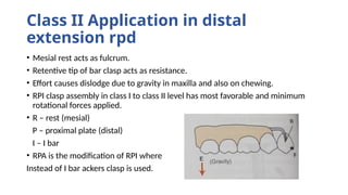 designing principles of Removable partial denture.pptx