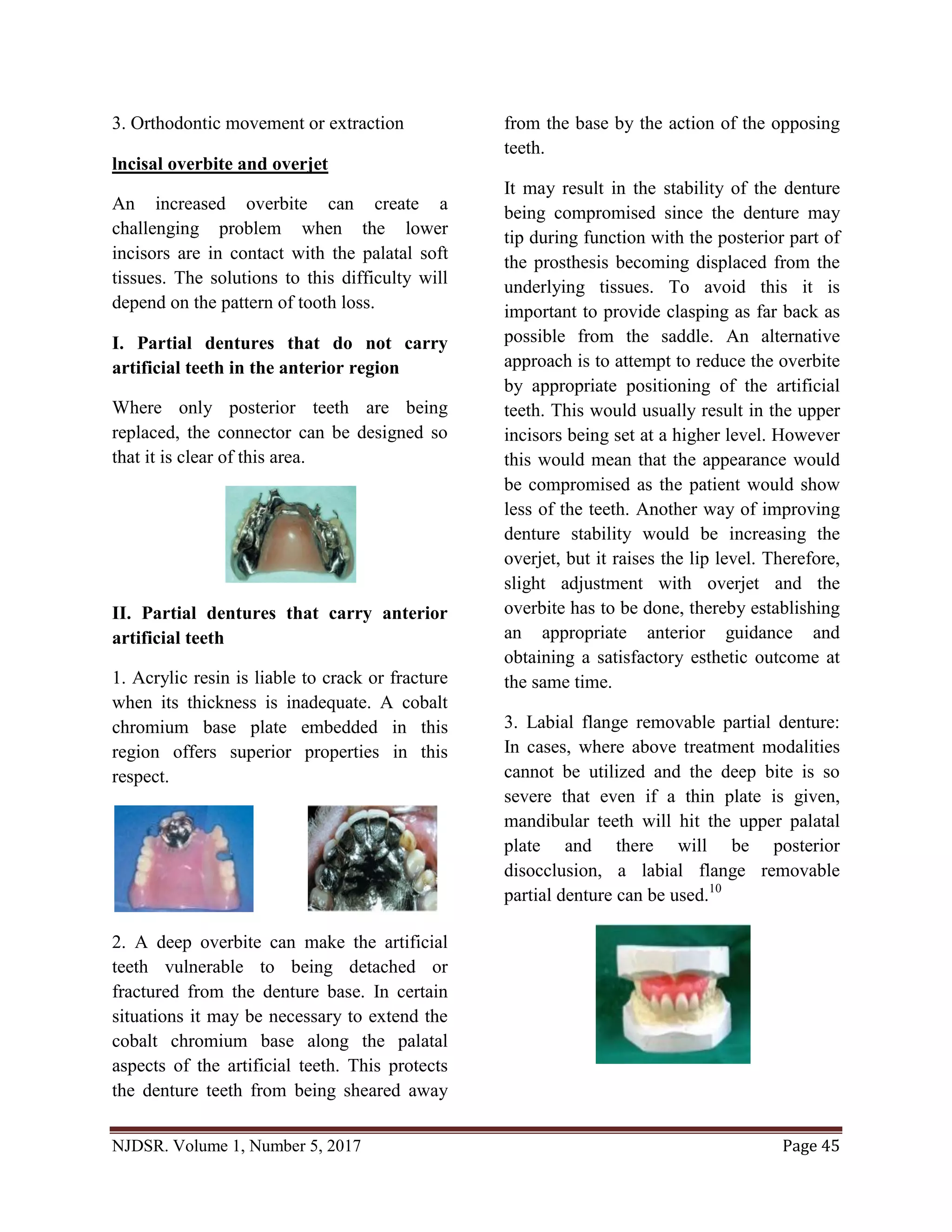Designing removable partial dentures around difficult dentition | PDF