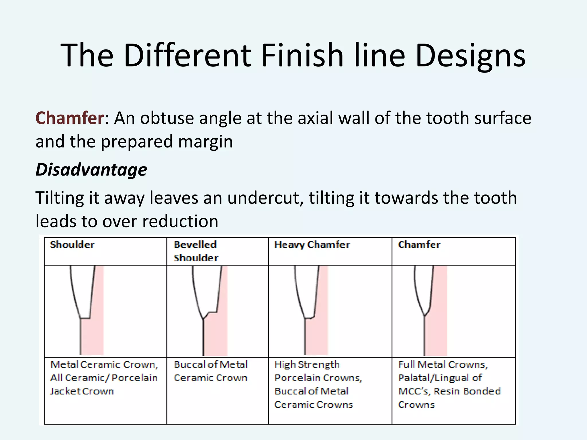 Design of a fixed Partial Denture (with Abutment Tooth Preparation) | PPTX