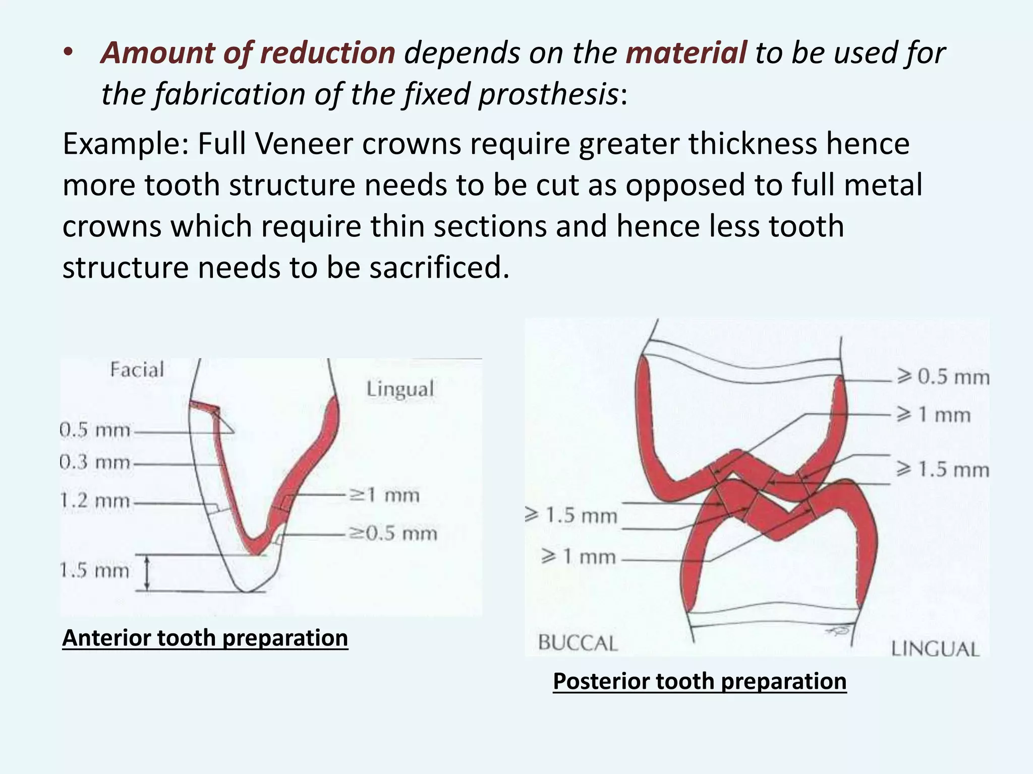 Design of a fixed Partial Denture (with Abutment Tooth Preparation) | PPTX