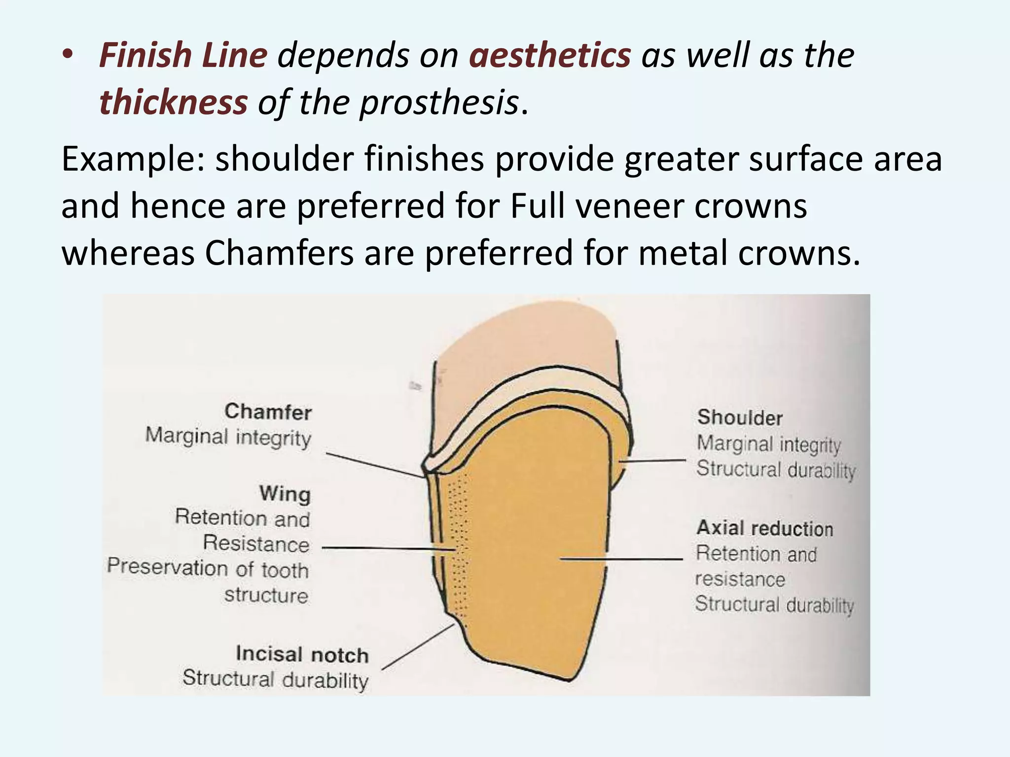Design of a fixed Partial Denture (with Abutment Tooth Preparation) | PPTX