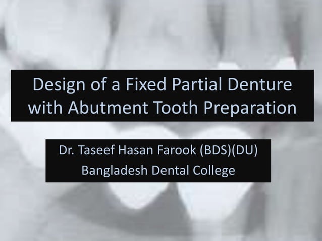 Design of a fixed Partial Denture (with Abutment Tooth Preparation) | PPTX | Dental Health ...